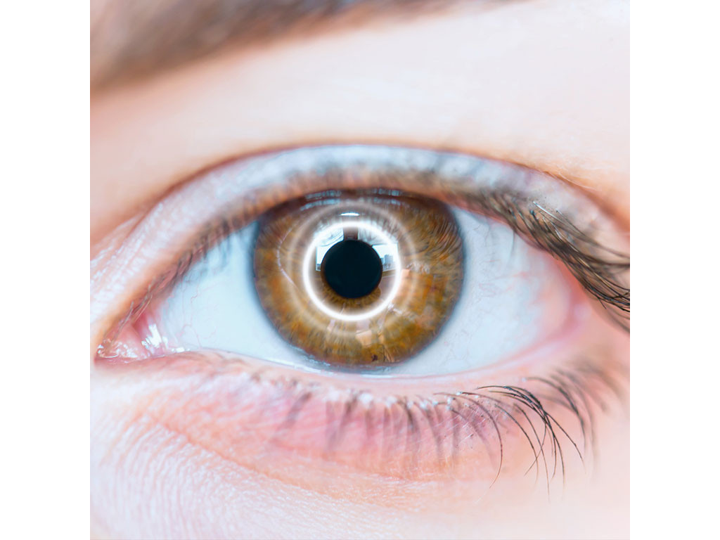 LED Spotring - Elektronik